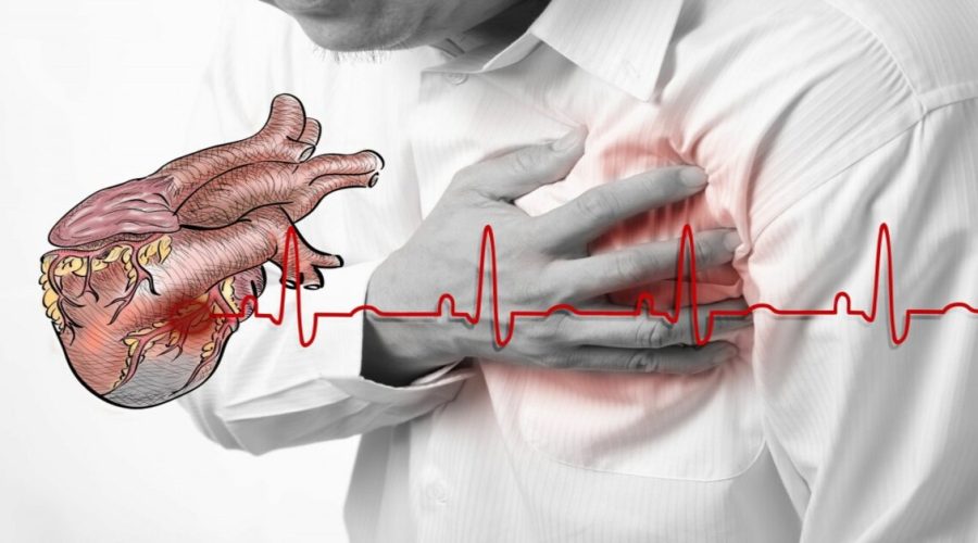 Ataque cardíaco: sintomas, causas e tratamentos – Dicas de Casa e Cozinha